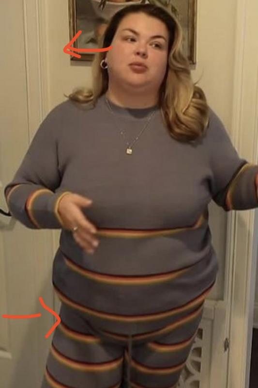 New England’s No Neck Fat Hunchback Hump Pt. 18 - page 16